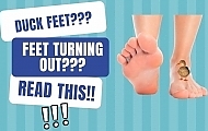 Do You Have ‘Duck Feet’? | Physical Therapy Blog | Health Tips & Insights